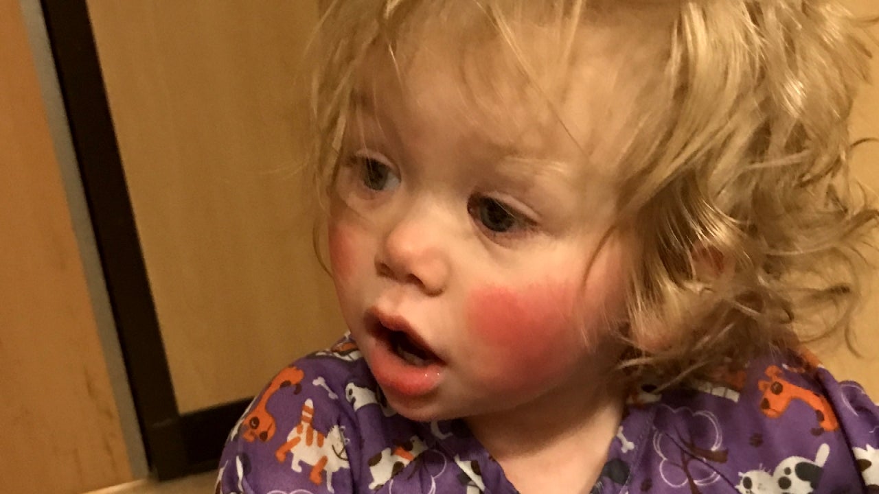 Meet 1-Year-Old Who’s Allergic to Tears | Inside Edition
