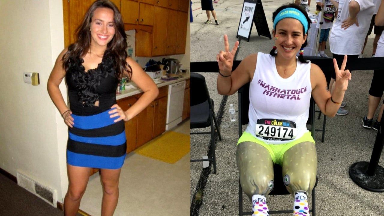 Cheerleader Takes First Steps After Losing Legs to Rare Medical ...
