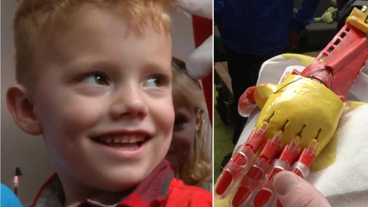 4-Year-Old Gets 3D-Printed Prosthetic Arm in Iron Man Colors | Inside ...